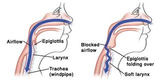 Sufocarea la copiii mici